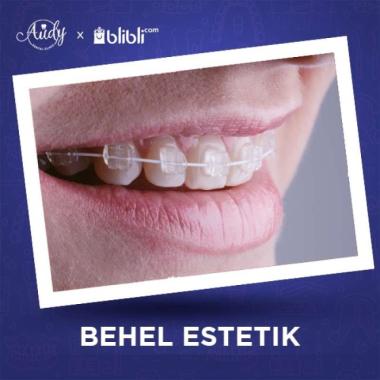 Promo Voucher Behel Metal American Mini Master Audy Dental Bogor di ...