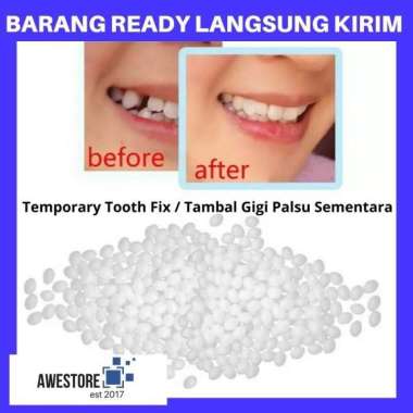 Jual Tambal Gigi Terbaik - Harga Terbaru 2026