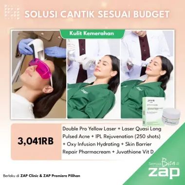 Jual Zap Laser 🔥 Harga Termurah & Terbaru di Juni 2026
